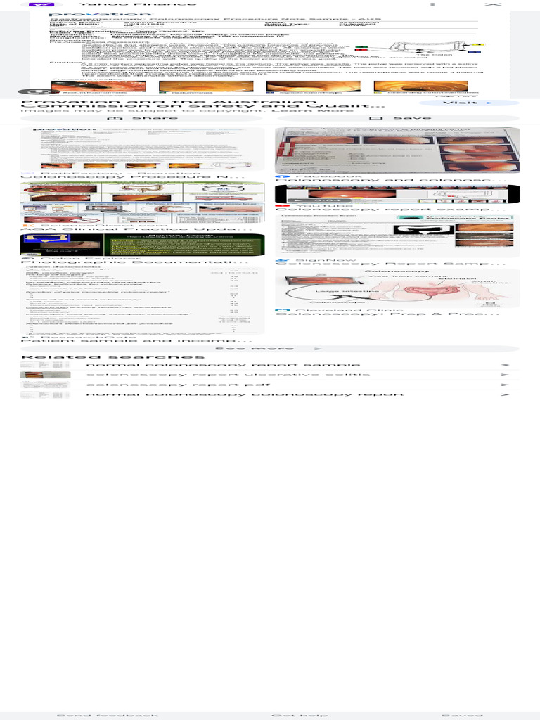 Colonoscopy Report - Google Search | PDF