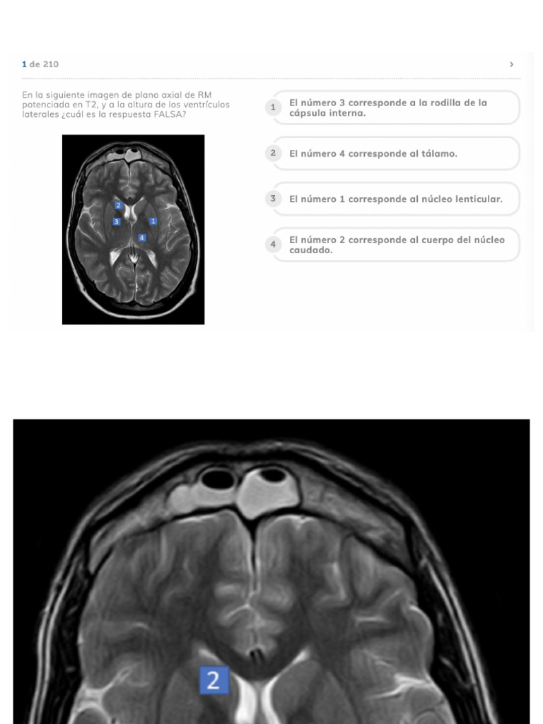 Megasimulacro Promir | PDF