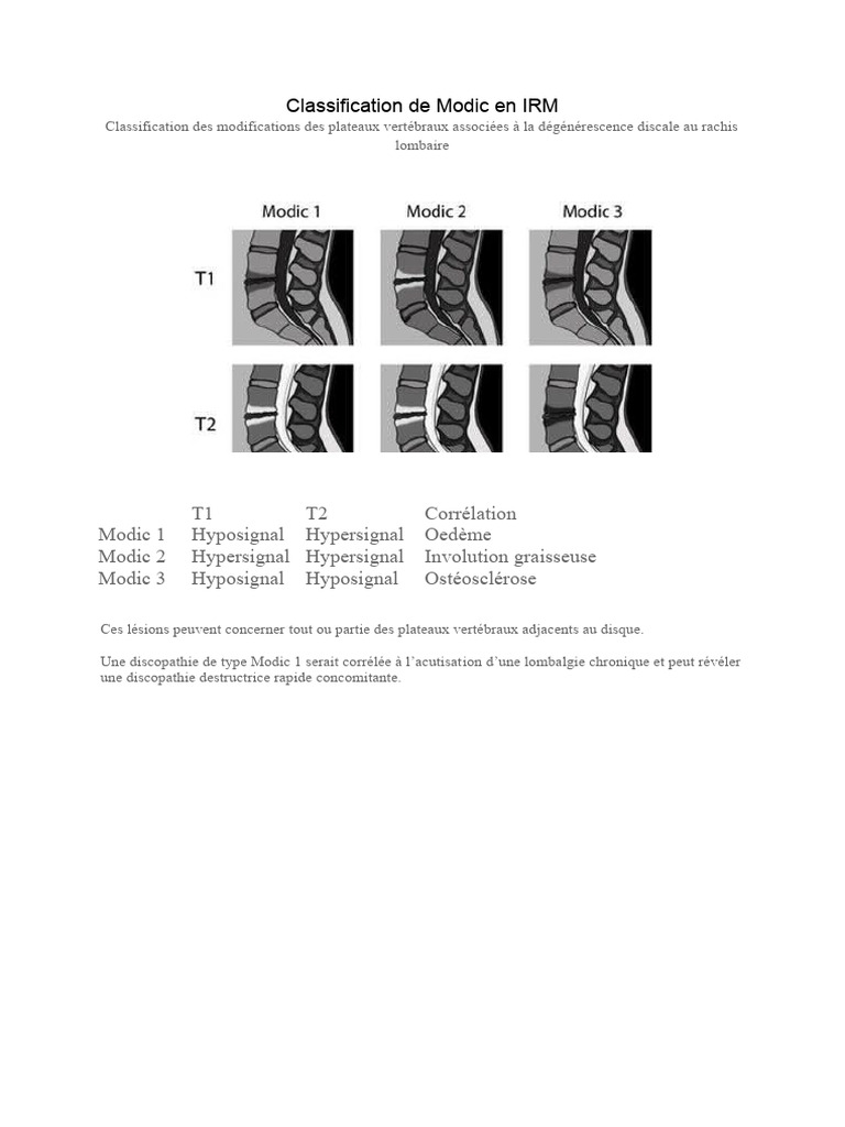 Classification de Modic en IRM - Dégénérescence discale | PDF