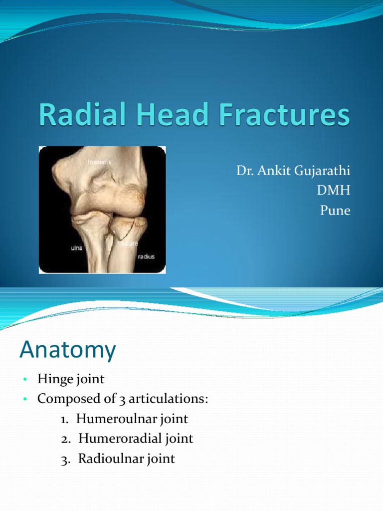 Radial Head Fractures | PDF | Elbow | Human Anatomy