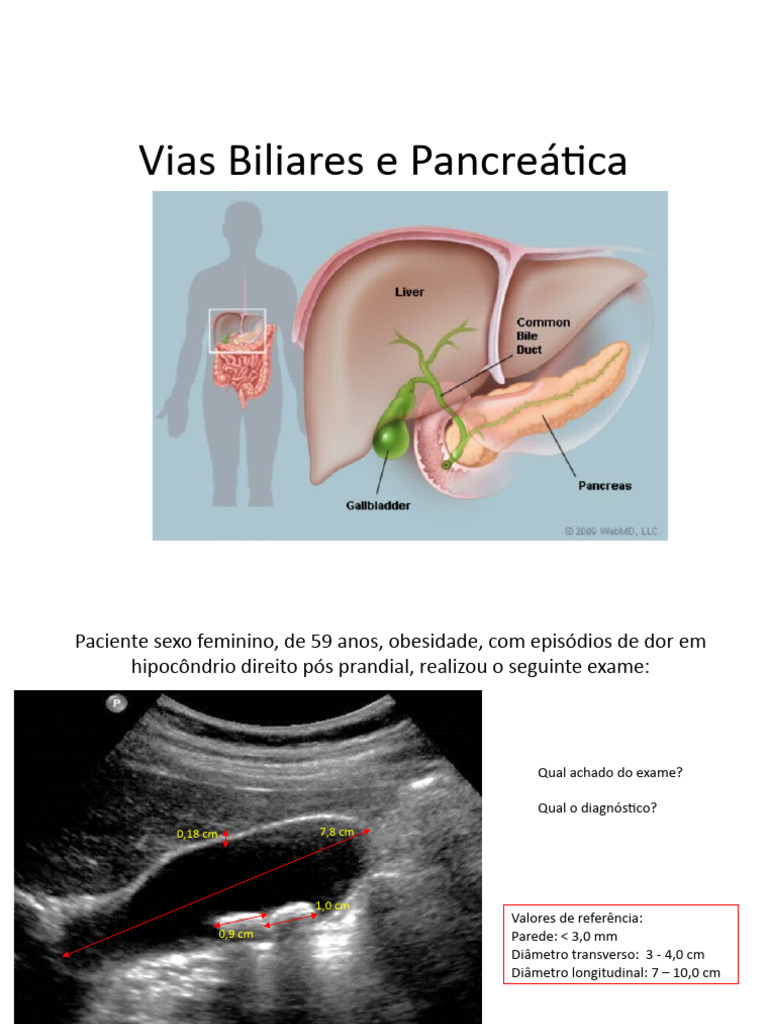Vias Biliares | PDF