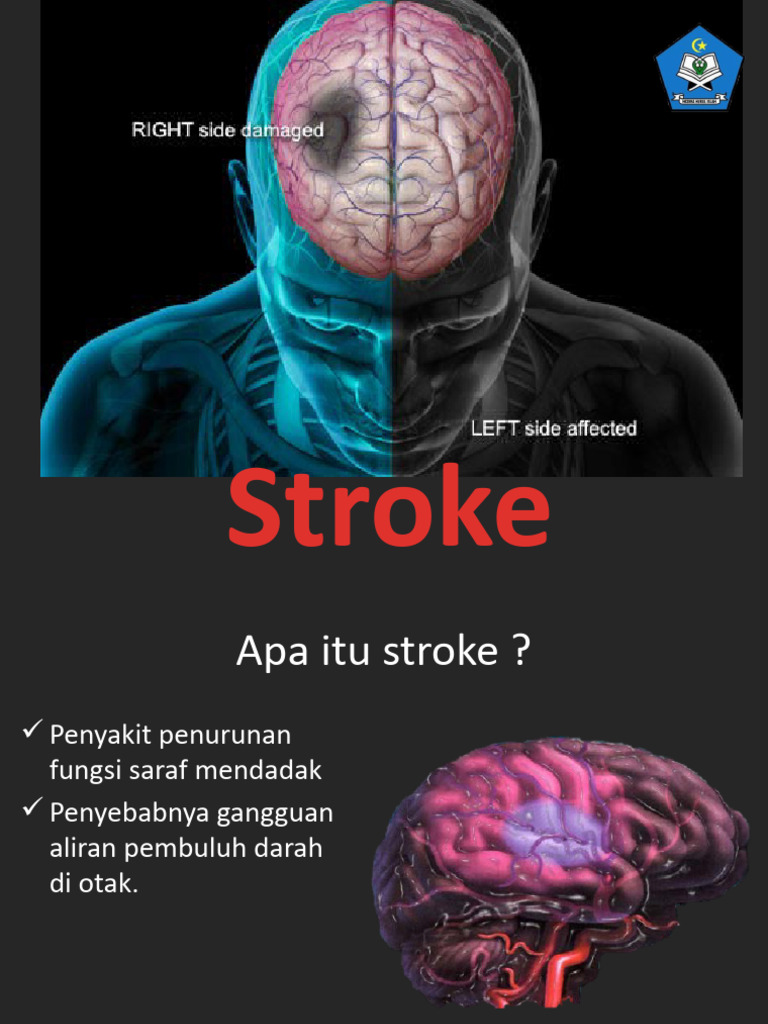 Booklet Stroke | PDF | Gaya Hidup