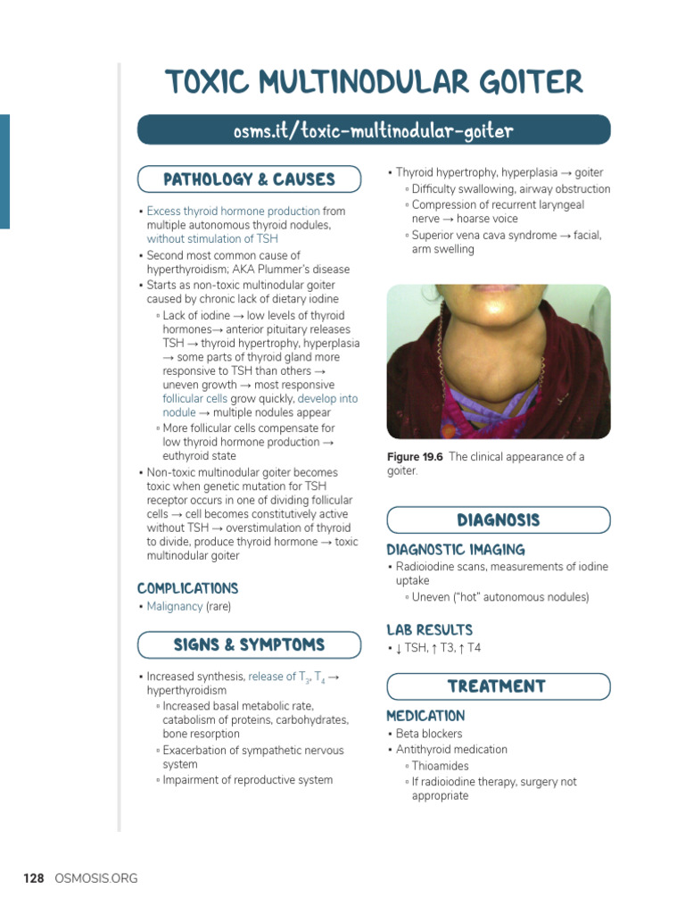 Toxic Nodular Goiter (Adenoma Tiroid) - OSMOSIS | PDF