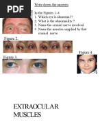 Extraocular Muscles & Ocular Motility Guide | PDF | Anatomical Terms Of ...