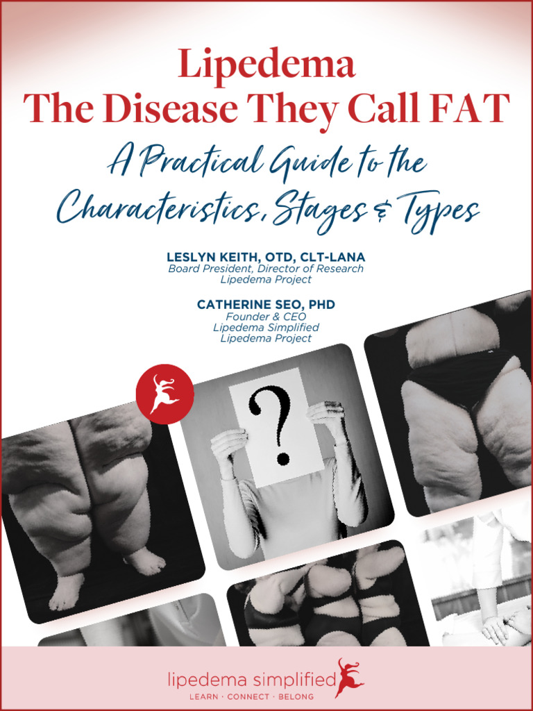 Lipedema Guide | PDF