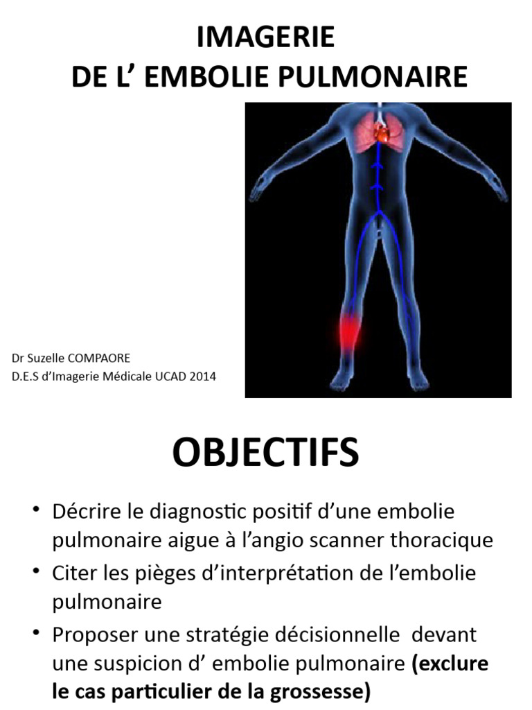 Embolie Pulmonaire Version 2 | PDF | Poumon | Vaisseau sanguin
