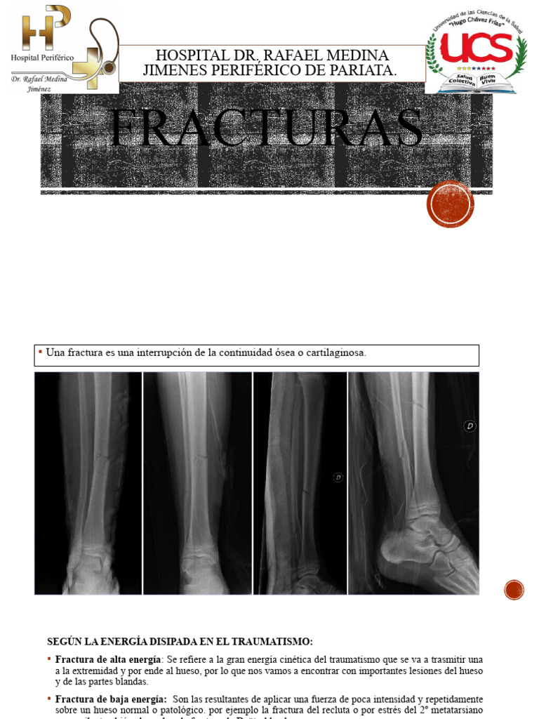 Frac Turas | PDF