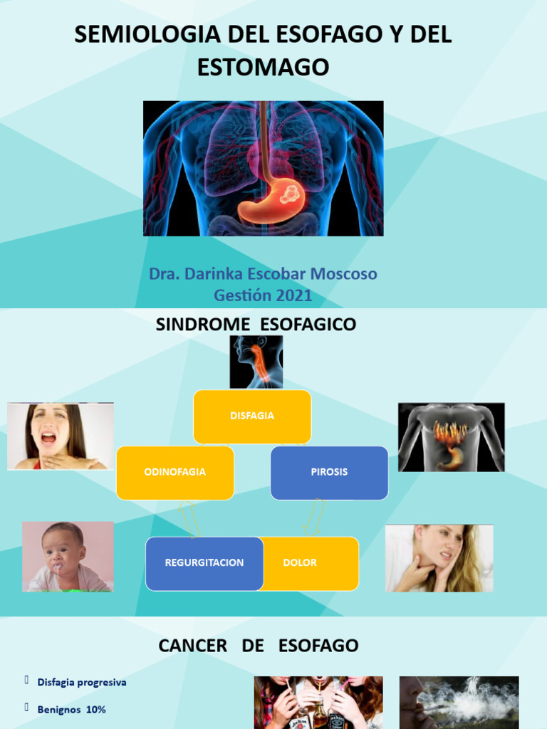 Semiologia Del Esofago y Estomago | PDF