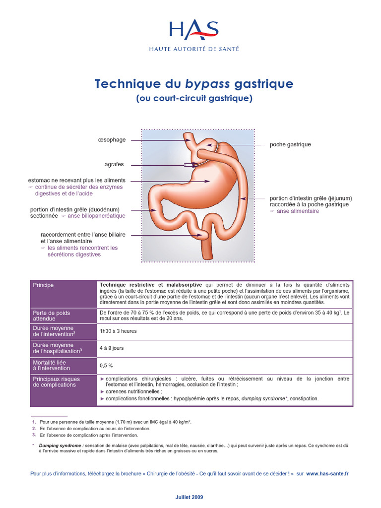 Fiche Technique Bypass 080909 | PDF