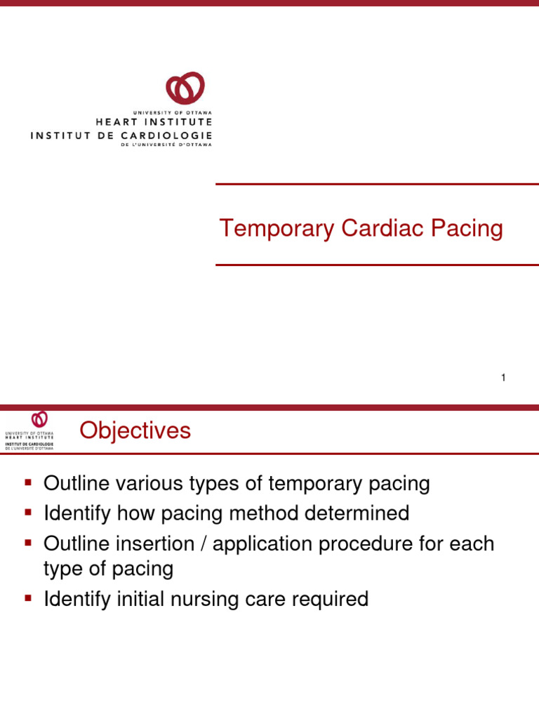 Pacing Presentation Notes | PDF | Artificial Cardiac Pacemaker | Atrium ...