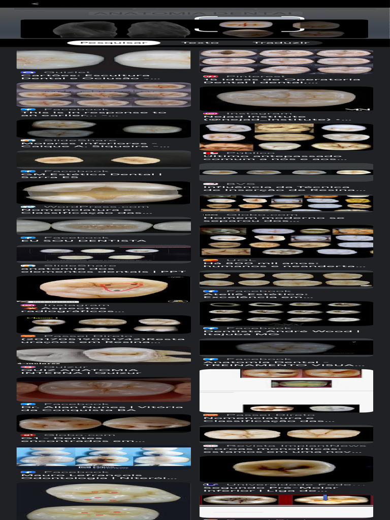 Anatomia do Dente 37 | PDF | Dente | Áreas da odontologia