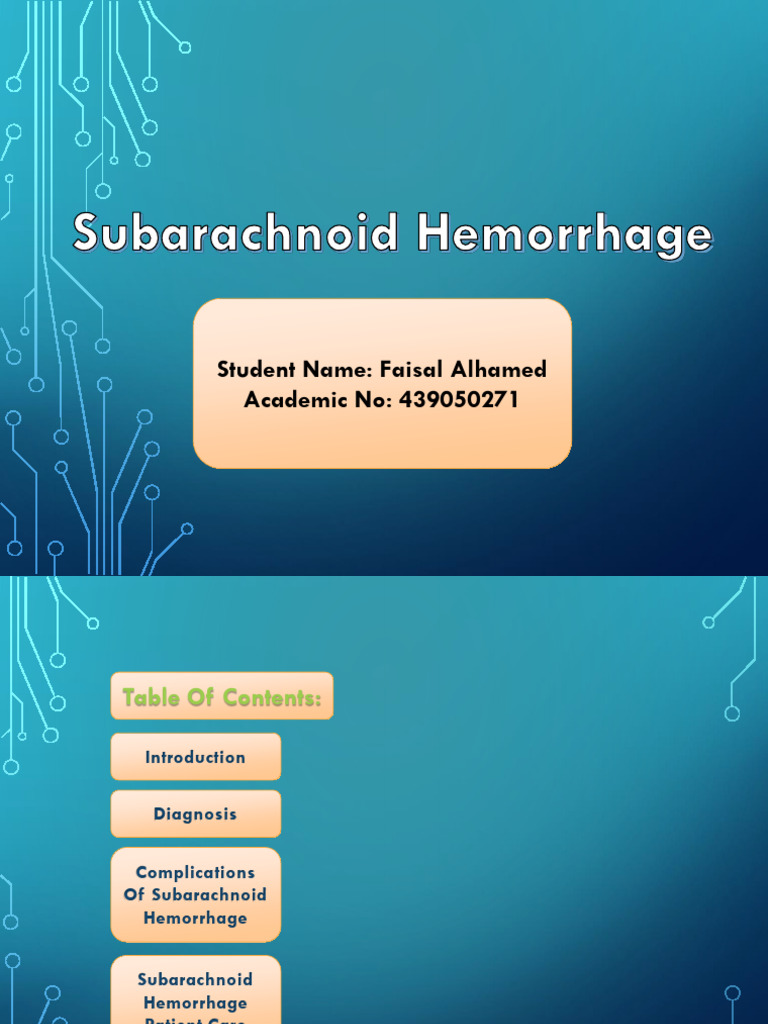 Subarachnoid_Hemorrhage | PDF | Headache | Nervous System