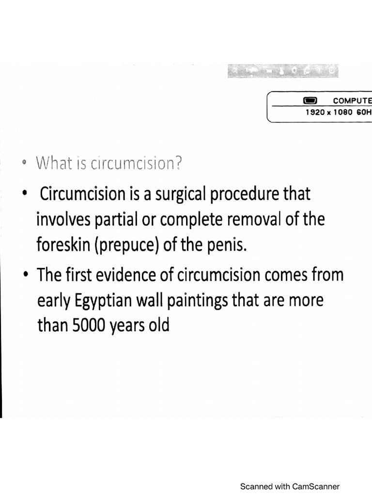 Circumcision - Surgery (Mamun Sir) | PDF