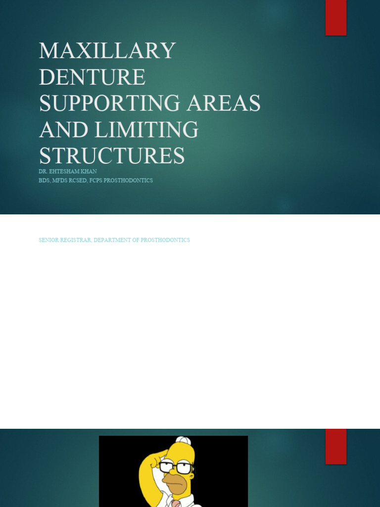 Maxillary Denture Supporting and Limiting Structures | PDF | Dentures ...