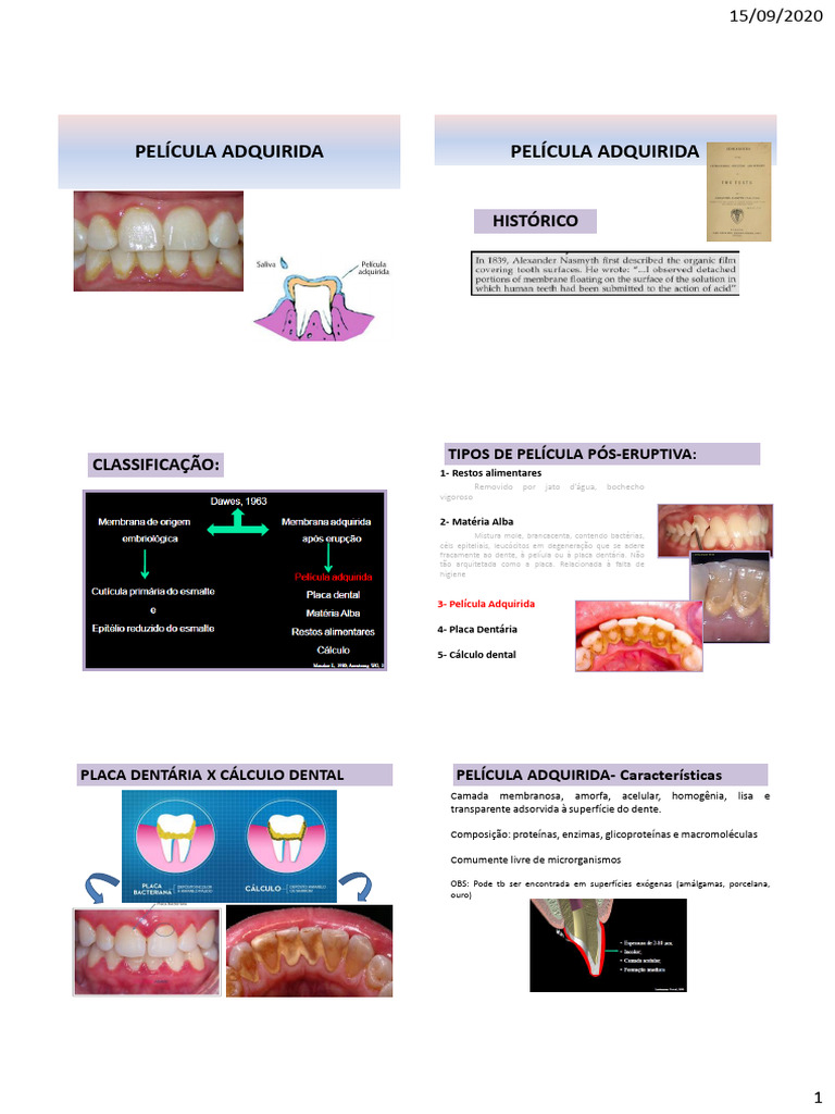 Slides Película Adquirida | PDF