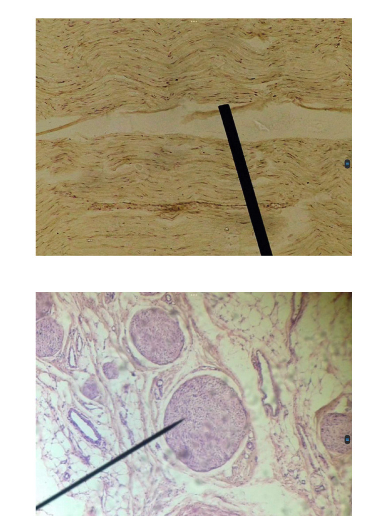 Muscle - Nervous Tissue | PDF