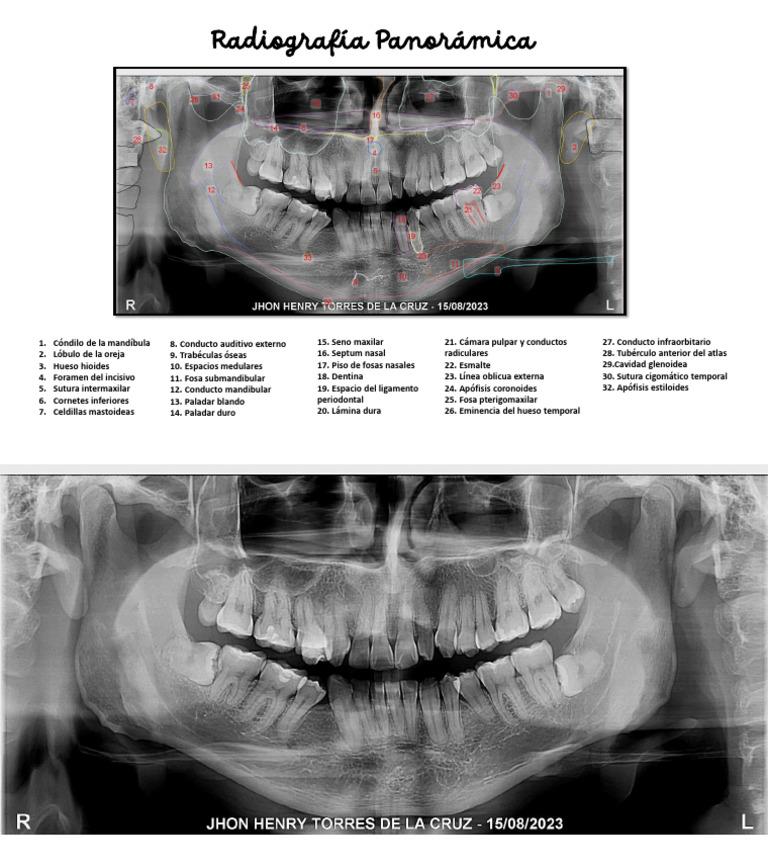 RX. PANORÁMICA - PDFSS | PDF