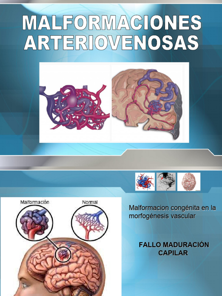 MALFORMACIONES VASCULARES Correcion | PDF | Capilar | Sistema cardiovascular