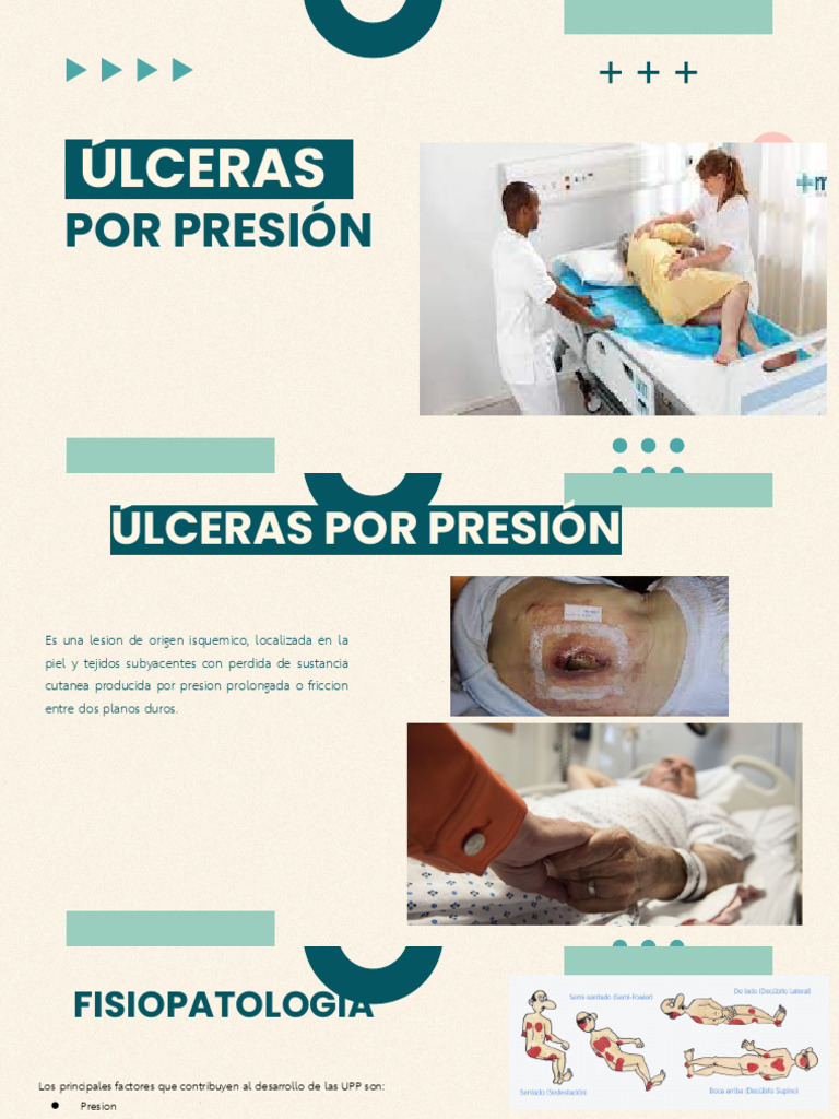 Úlceras Por Presión | PDF