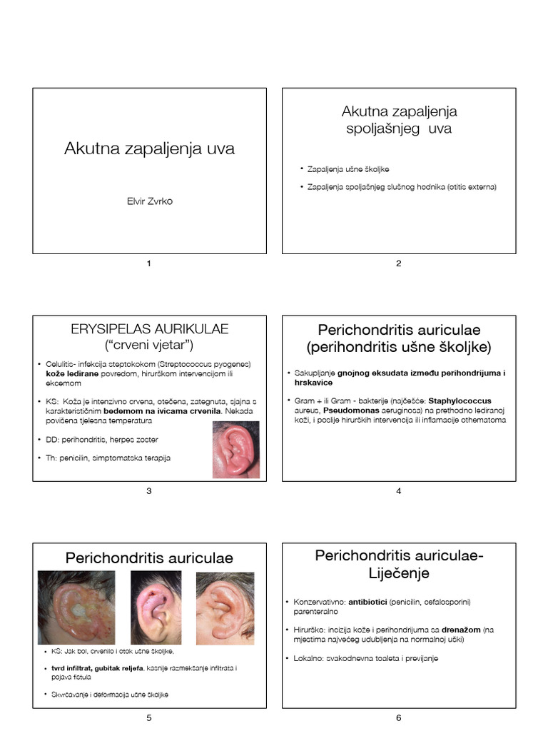 Akutne upale uva-ST | PDF