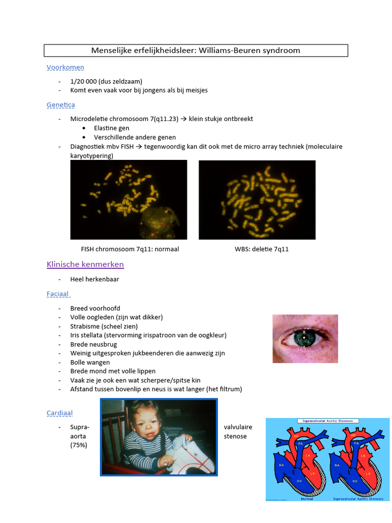 Williams-Beuren Syndroom | PDF