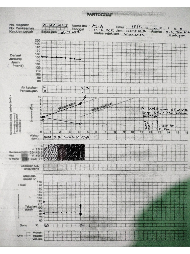 Partograf Depan | PDF