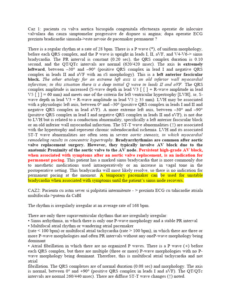 Aritmii ECG | PDF | Electrocardiography | Cardiovascular System