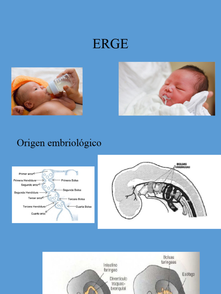 ERGE en Pediatría: Diagnóstico y Tratamiento | PDF