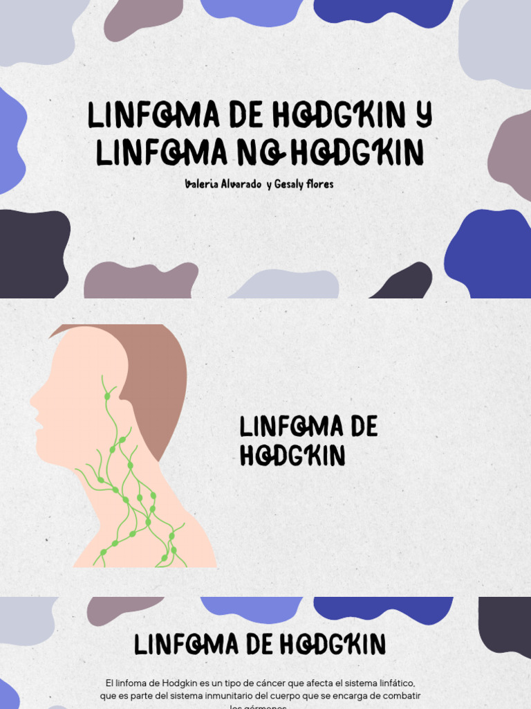 Linfoma de Hodgkin y Linfoma de No Hodgkin | PDF | Cáncer | Medicina CLINICA