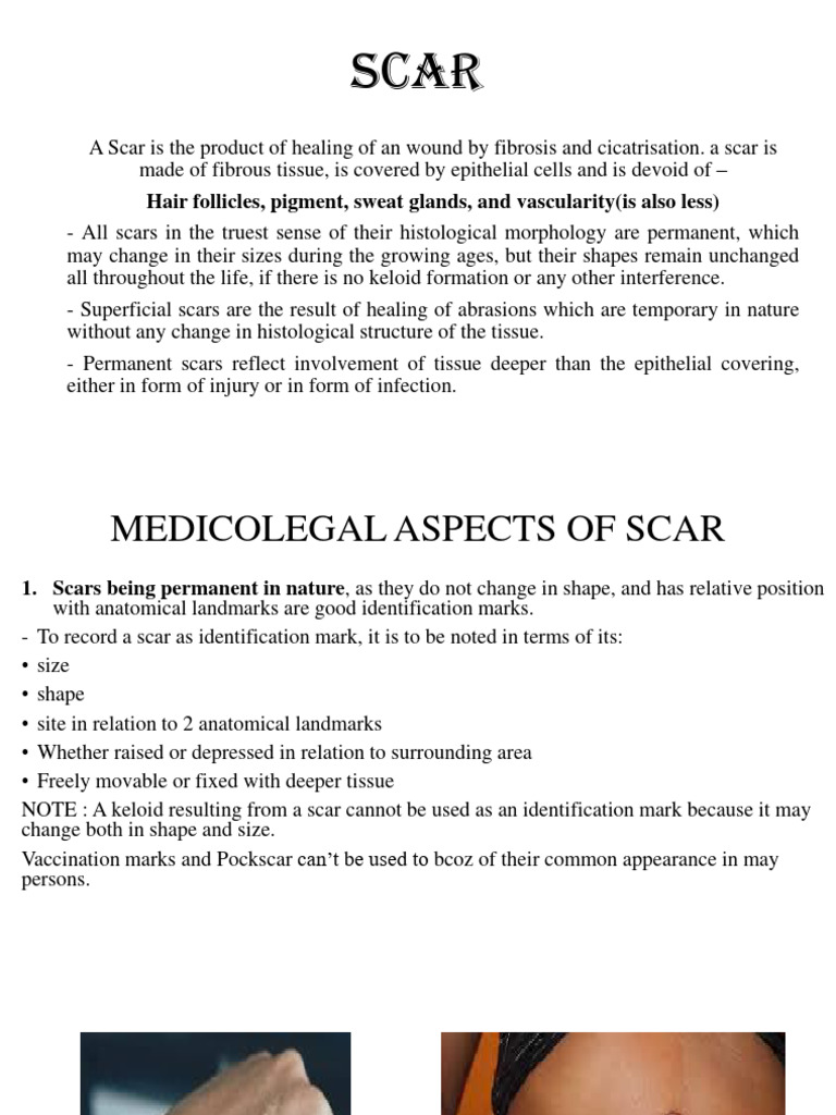 Scar PDF | PDF | Scar | Wound