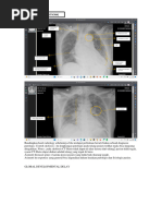 Panduan Lengkap Foto Thorax dan Teknik Pembacaan | PDF