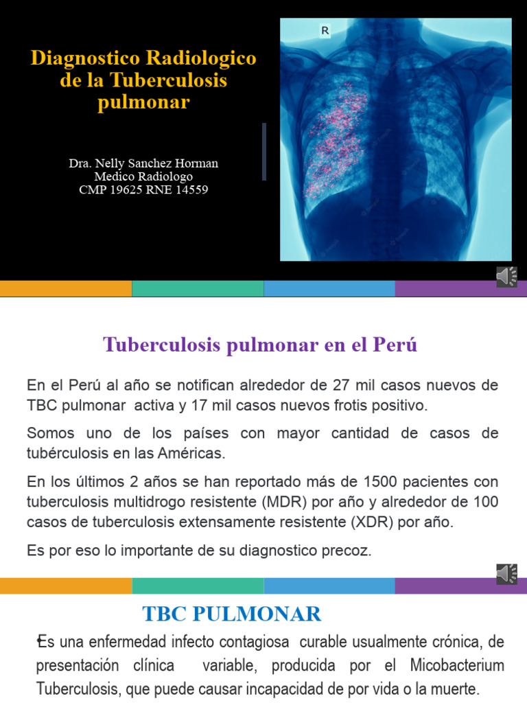 Patrones Radiologicos de La TBC Pulmonar | PDF | Tuberculosis | Inmunología