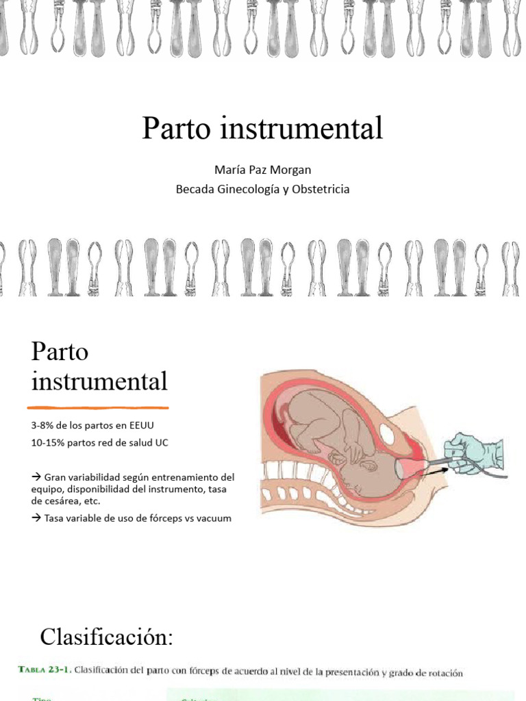 Parto instrumental | PDF | Parto | Maternidad