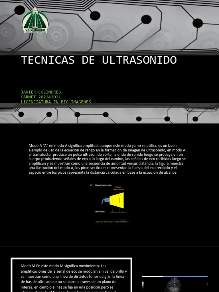 Tecnicas de Ultrasonido | Descargar gratis PDF | Ultrasonido | Sonido