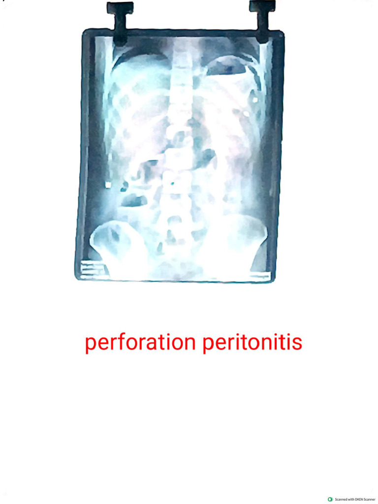 Surgery X- Rays | PDF