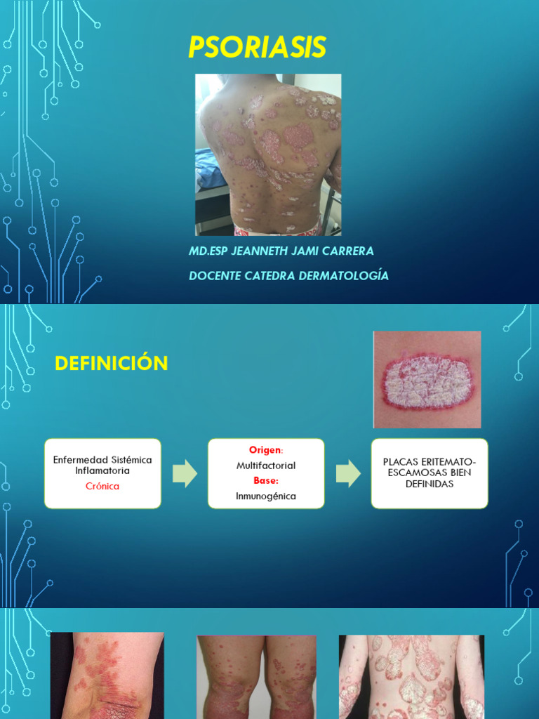 Expo Psoriasis | PDF | Psoriasis | Medicina