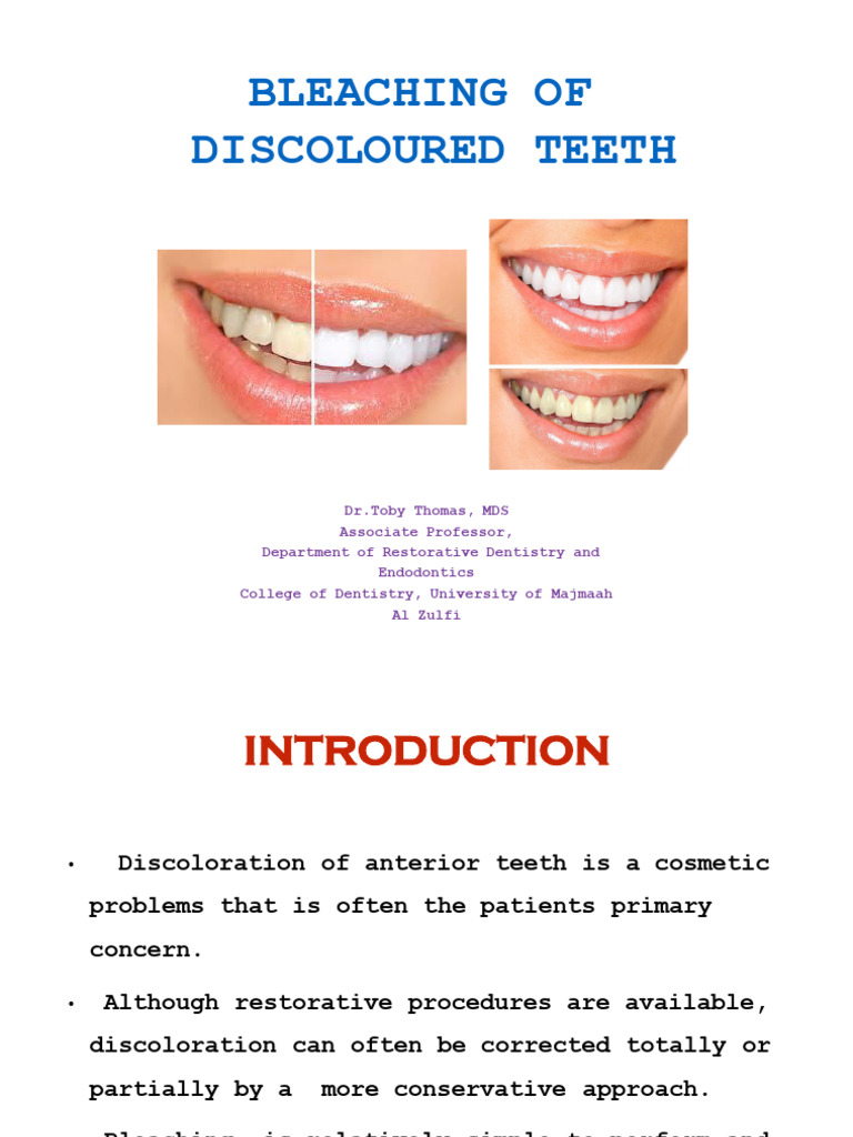 13 Bleaching | PDF | Hydrogen Peroxide | Tooth Enamel