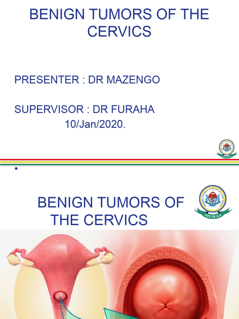 Benign Tumor of The Cervix | PDF | Human Reproduction | Medicine