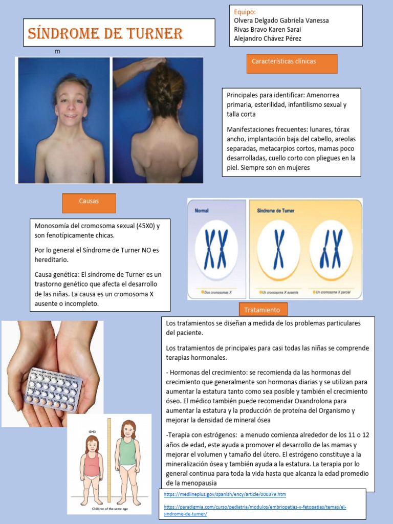Sindrome de Turner | PDF | Causas de la muerte | Especialidades Medicas