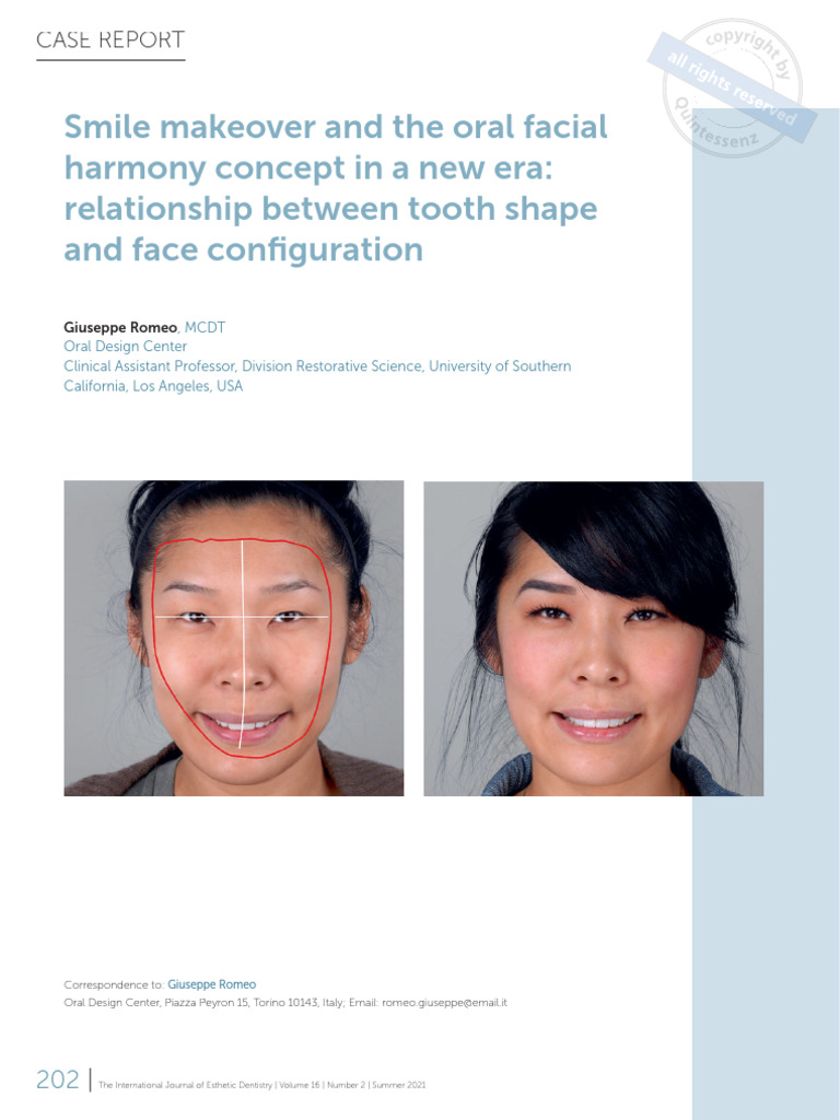 Smile Makeover and The Oral Facial Harmony Concept in A New Era ...