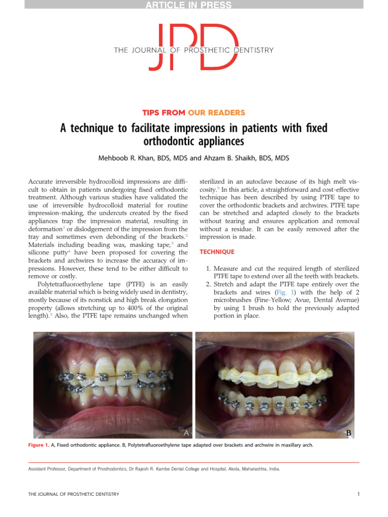 A Technique To Facilitate Impressions in Patients With Fixed ...