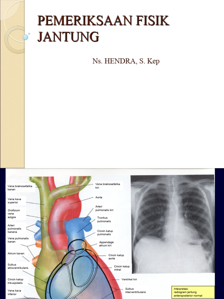 Pemeriksaan Fisik Jantung: Inspeksi, Palpasi, Perkusi, Auskultasi | PDF ...