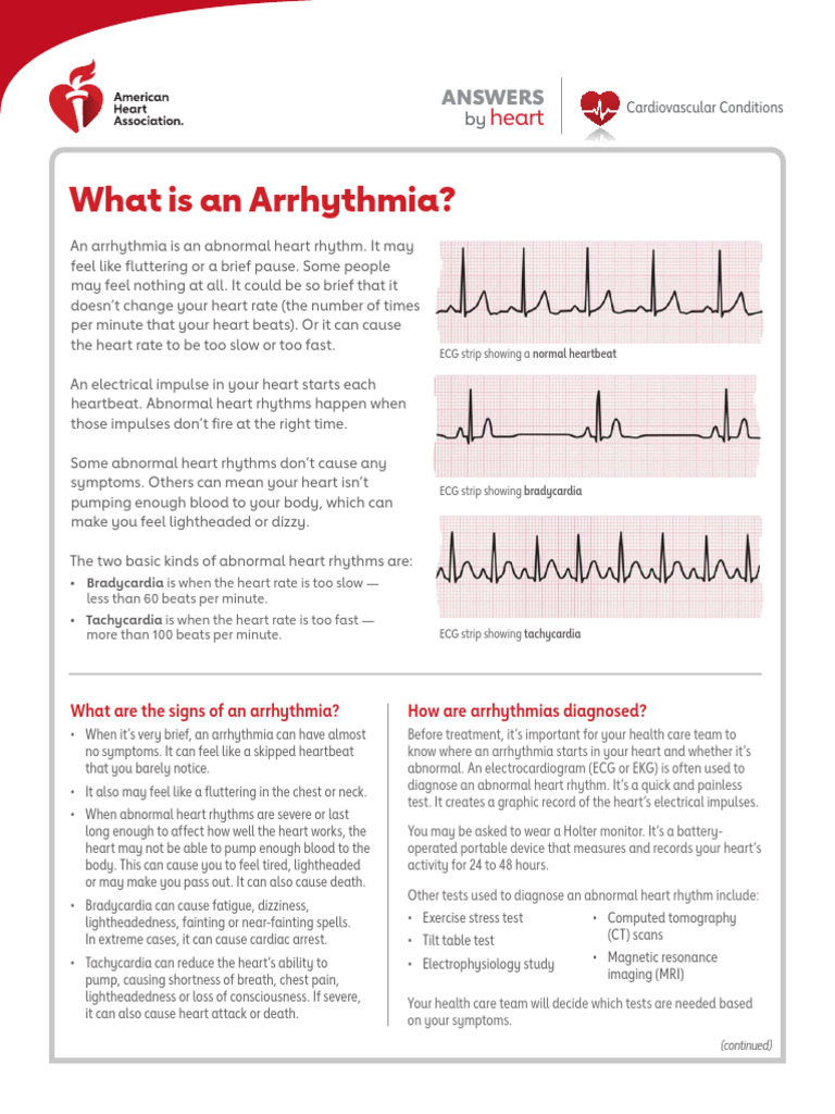 What Is Arrhythmia | PDF | Heart | Heart Rate