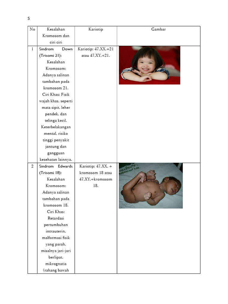 Sindrom Kromosom | PDF