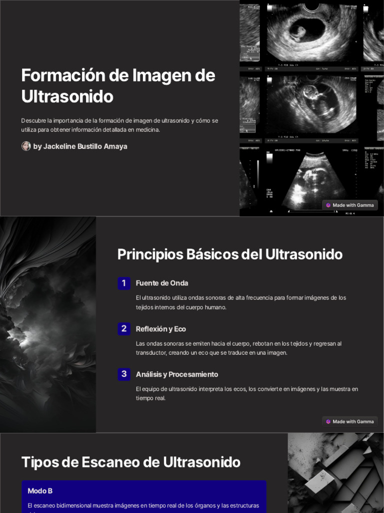 Formacion de Imagen de Ultrasonido | PDF | Ultrasonido