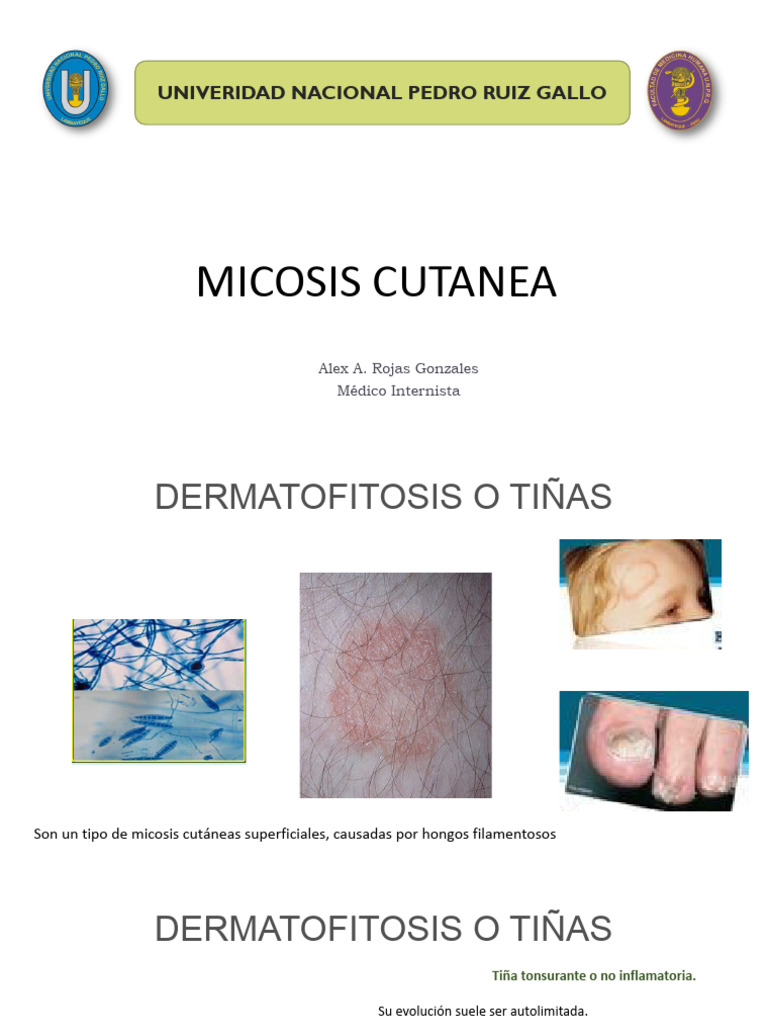CLASE 4 - DERMATOLOGIA TIÑAS 2023.pptx | PDF | Candidiasis | Hongo