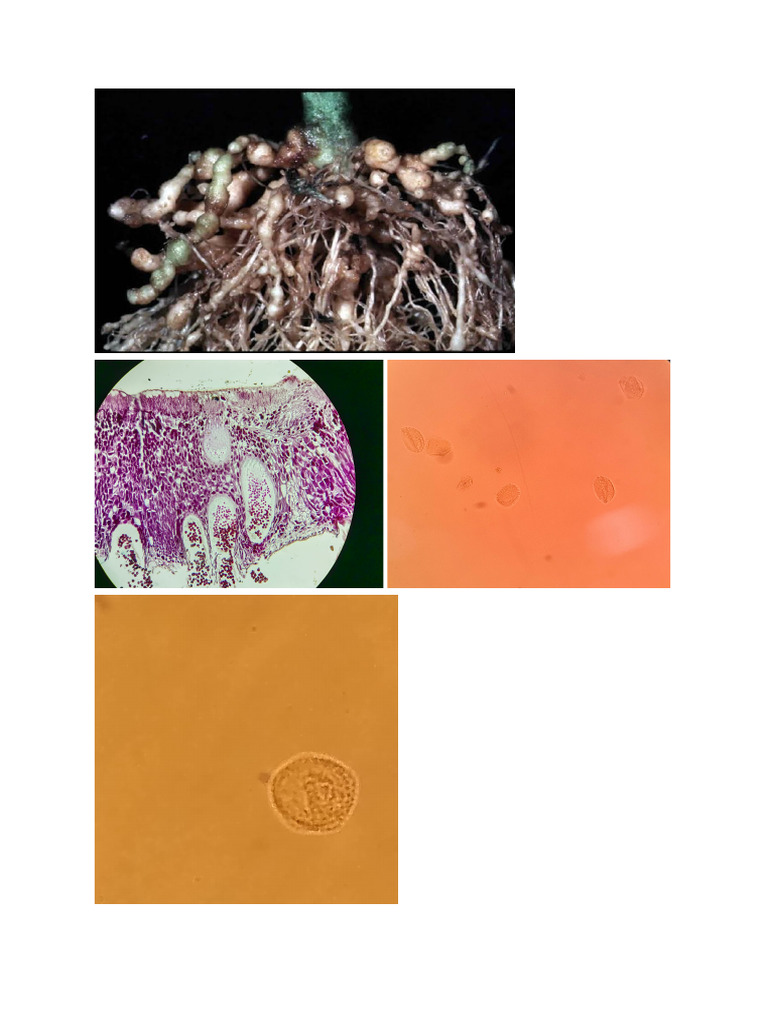 Royas y Esporas | PDF