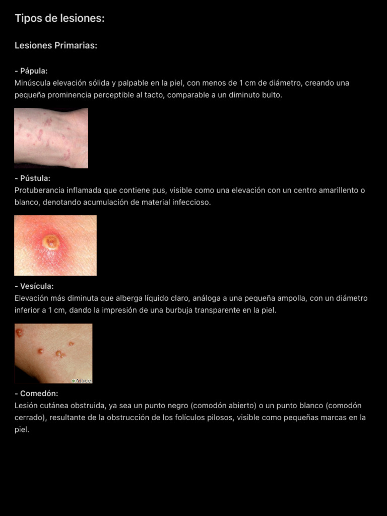 Tipos de Lesiones | PDF | Piel | Epidermis