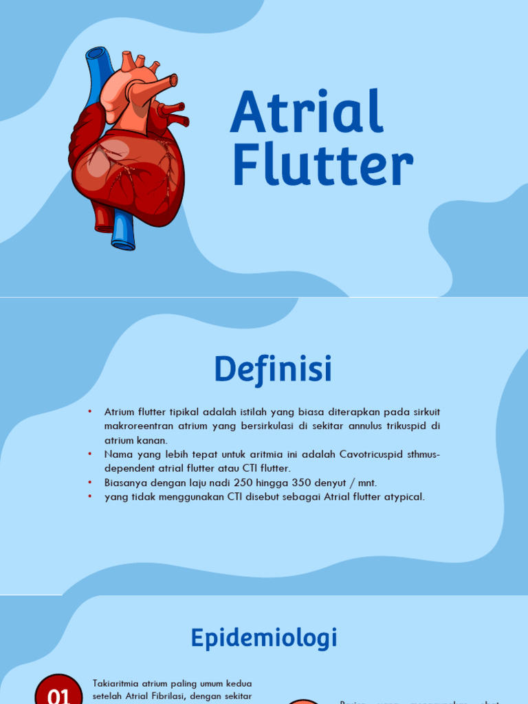 Atrial Flutter | PDF