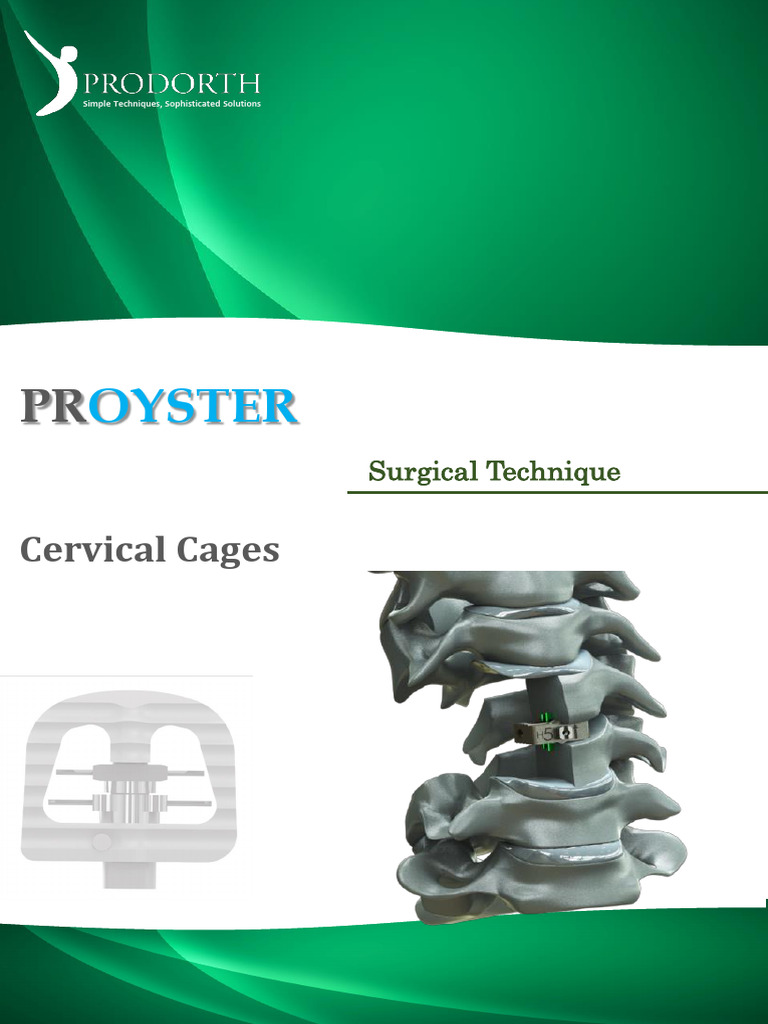 1) Surgical Technique Cervical Cages | PDF | Vertebral Column ...